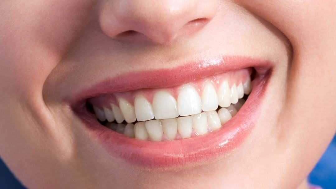 Your Guide to Getting and Living with a New Smile - Medi Port Services ...